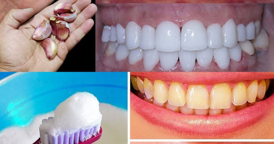 The Secret to Whitening Teeth in Just 2 Minutes! Shiny, Pearly Teeth ...
