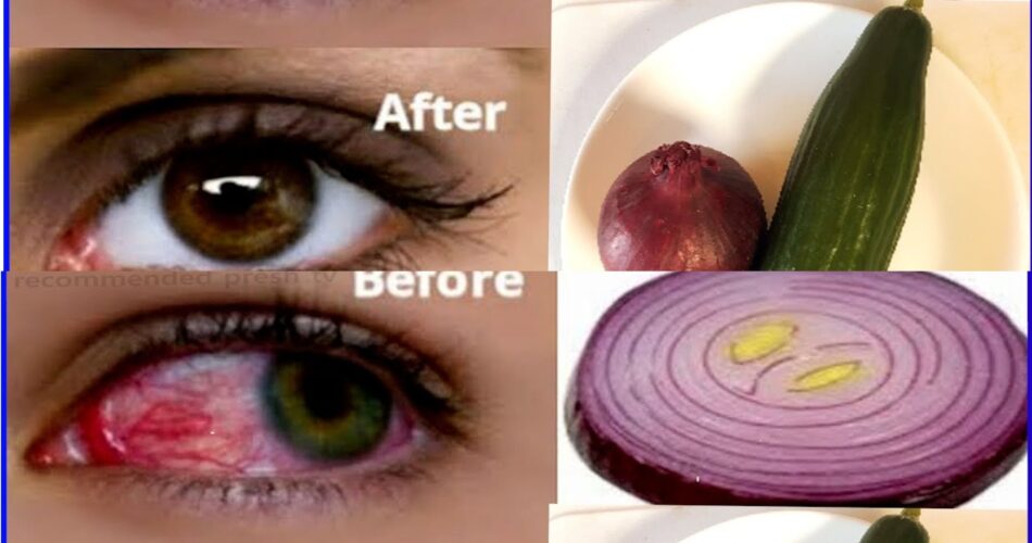 Improve Your Eyesight Naturally at Home in 5 Days – With Onion? Here’s ...