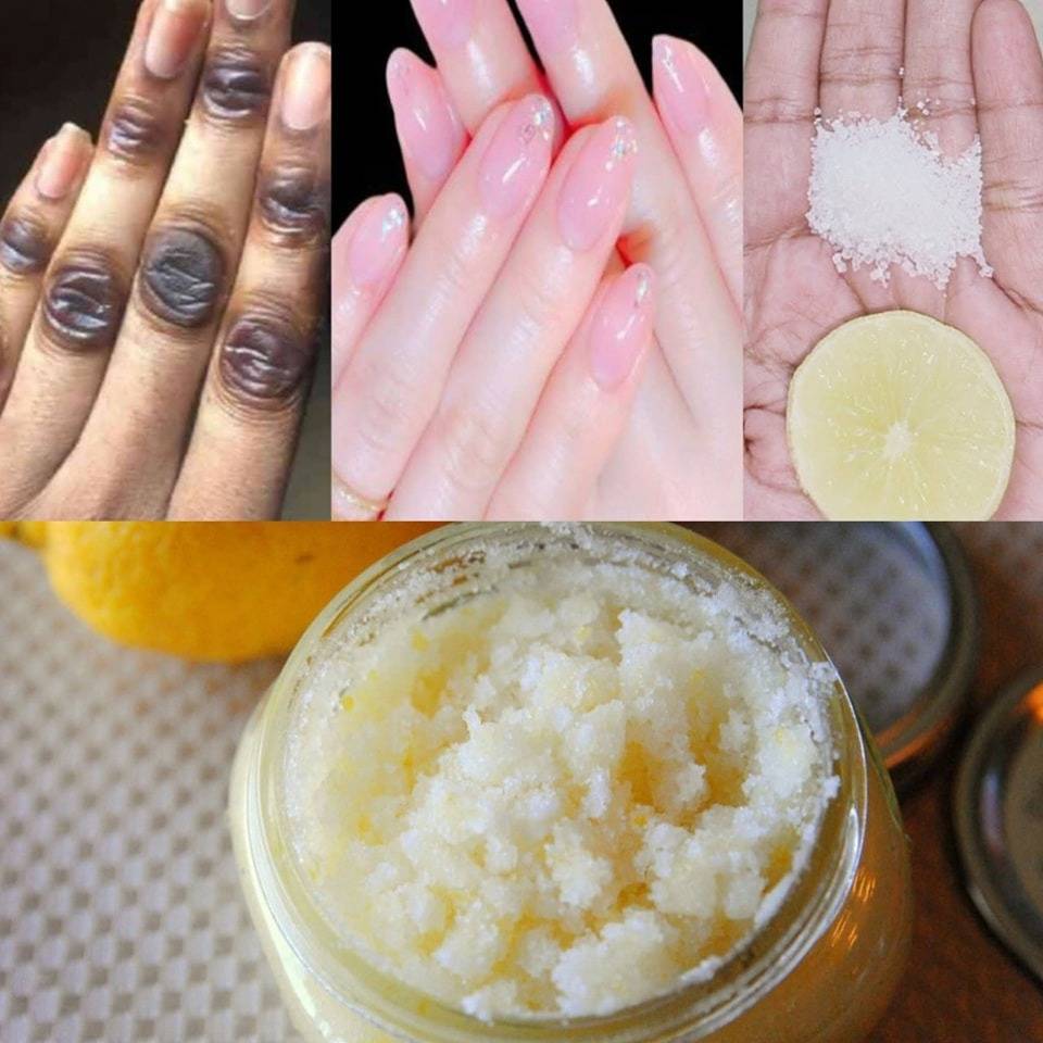 5 Simple Ways to Make Hands Look Younger and Rejuvenate Your Skin - Dr ...