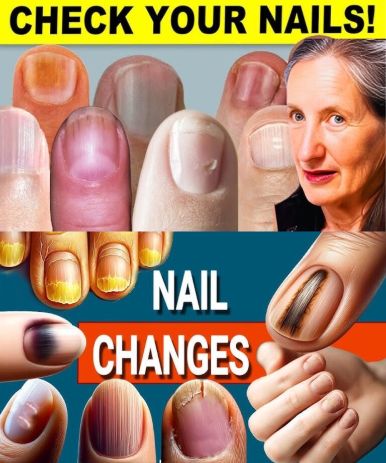 9 Things Your Nails Can Tell You About Your Health - Dr. Barbara Health