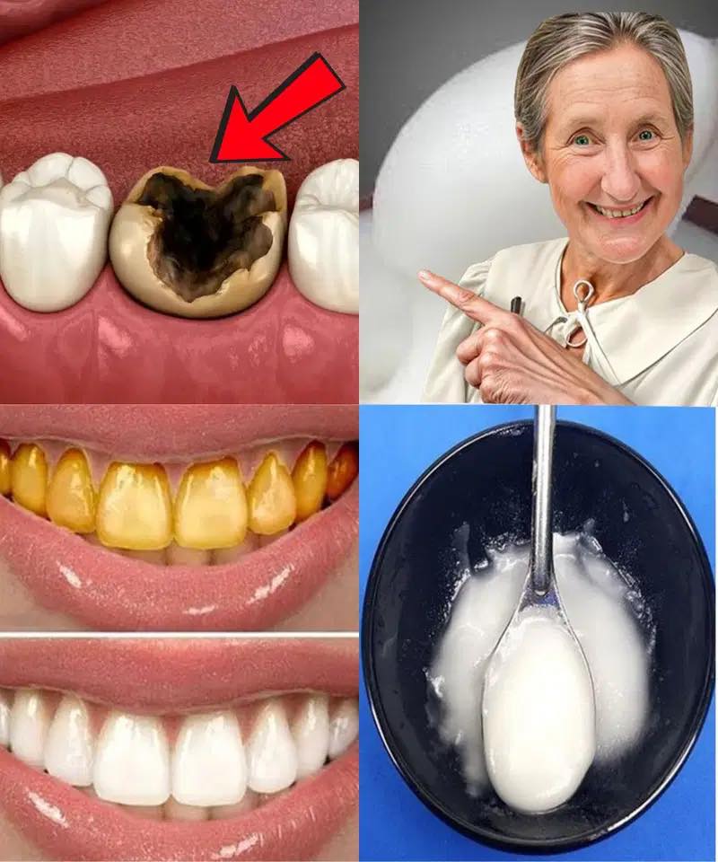 Naturally Reverse Early Tooth Decay 6 Proven Tips to Strengthen Enamel ...
