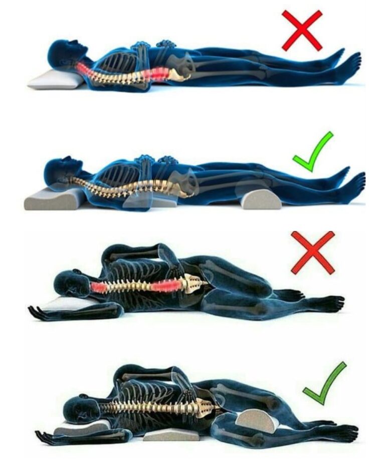 Discover Why Your Sleeping Posture Is Key to Your Health! - Dr. Barbara ...