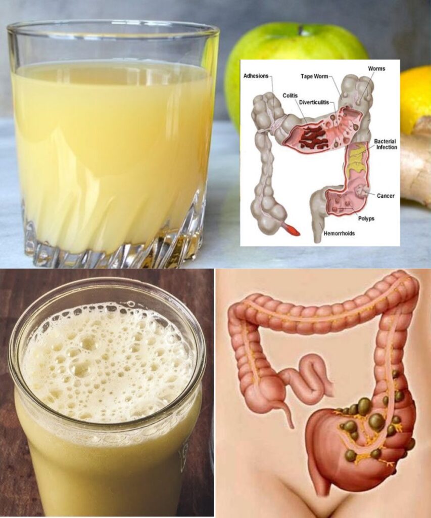 How to Clean Your Colon and Remove Waste Naturally - Dr. Barbara Health