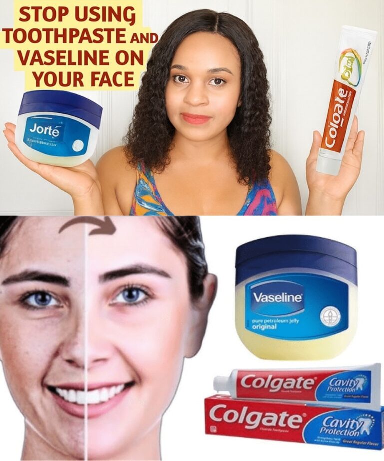 Toothpaste and Vaseline The Viral Skincare Hack - Dr. Barbara Health